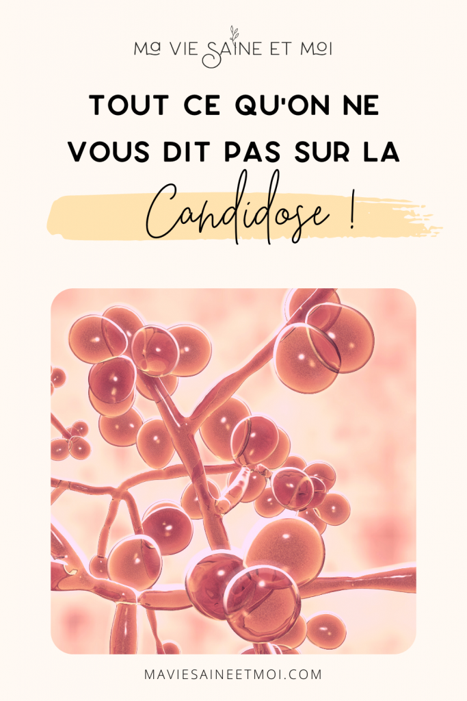 Tout ce que vous devez savoir sur la candidose : les causes et ...